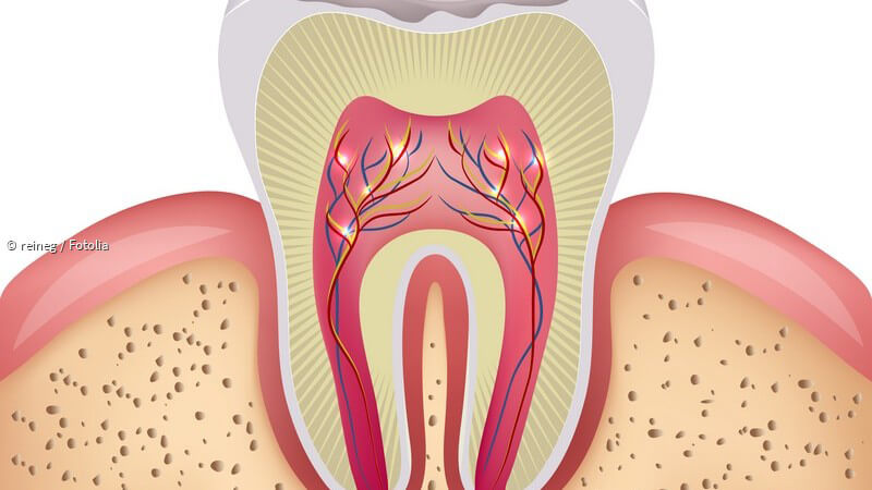 ᐅ Karies - Ursachen, Symptome und Behandlung