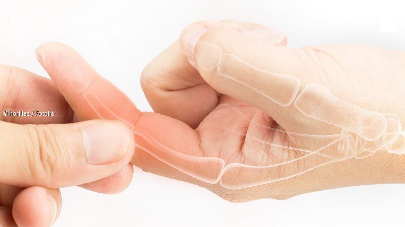 ᐅ Fingerbruch - Fraktur des Fingerknochens: Ursachen, Symptome und ...