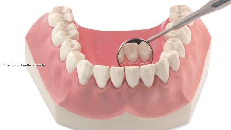 ᐅ Entstehung, Erkennung und Vorbeugung von Zahnstein