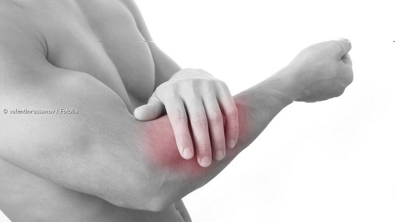 ᐅ Prellungen: Symptome, Arten und Behandlung