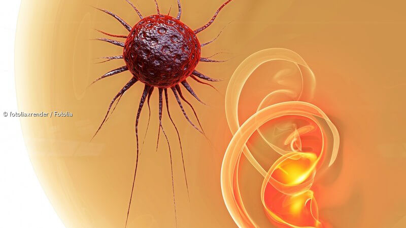 ᐅ Gliom - Arten, Häufigkeit, Diagnose und Therapie