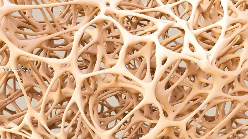 ᐅ Osteomalazie - Ursachen, Beschwerden und Therapie