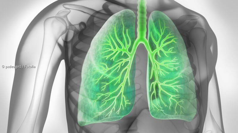 ᐅ Kleinzelliges Bronchialkarzinom - Ursachen, Therapie und Prognose