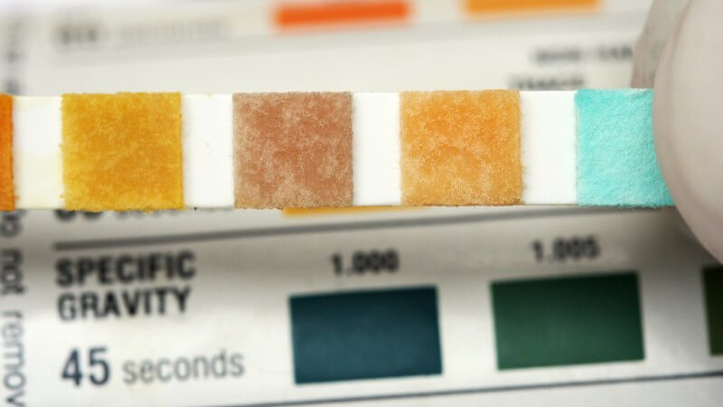 ᐅ Laborwerte: Das bedeutet der Laborbefund