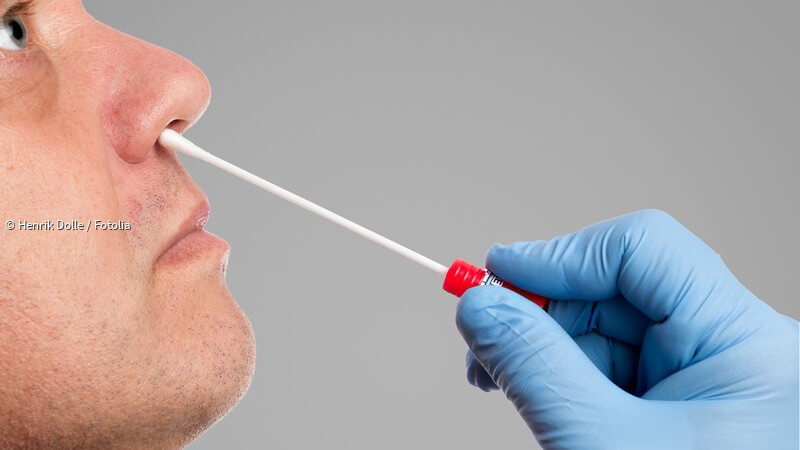 ᐅ Anwendung und Ablauf eines Abstrichs