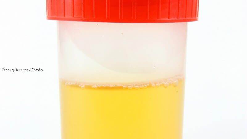 ᐅ Der Urin - Wird in den Nieren gebildet und über die ableitenden ...